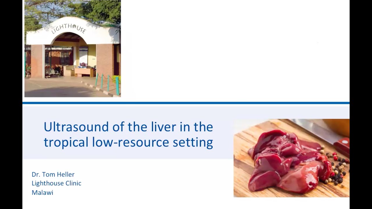 Ultrasound of the Liver in the Tropical Low Resource Setting - Dr Tom ...