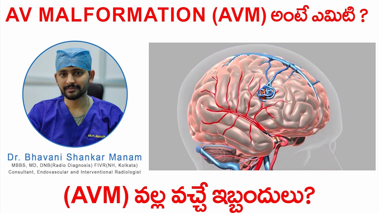 AV MALFORMATION (AVM) అంటే ఎమిటి? (AVM) వల్ల వచ్చే ఇబ్బందులు? - YouTube