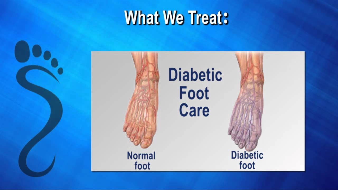Welcome to Martin Foot and Ankle: Dr. Rick Martin Greeting - YouTube