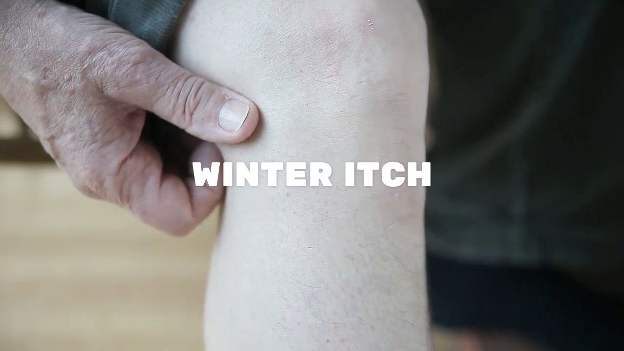 Dry Skin Treatment- Dr. Harold F. Farber, MD - Center for Dermatology ...