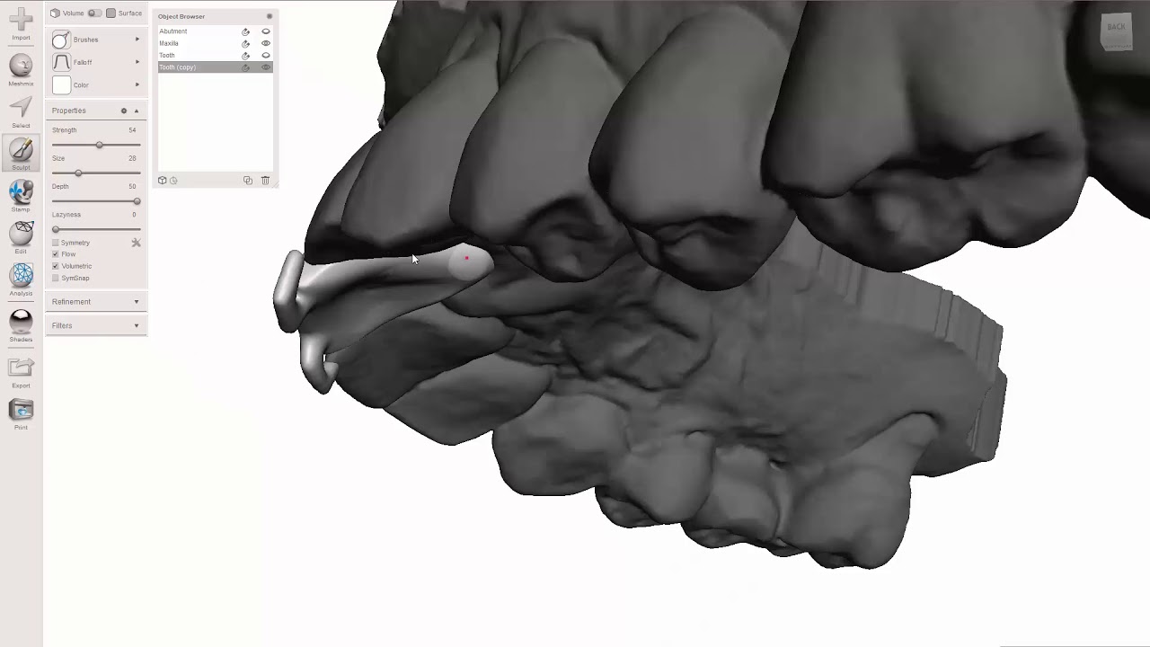 Implant Temp Crown - (Preview) Shell Crown - YouTube