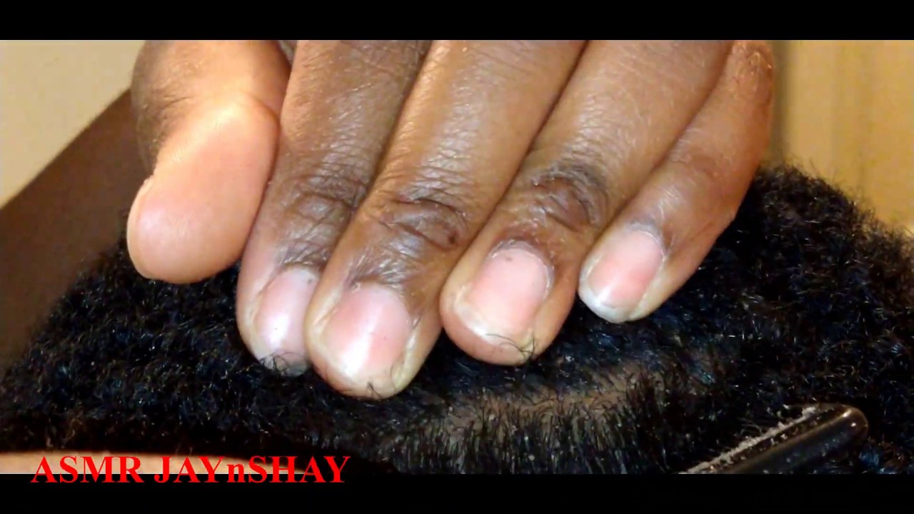 Scalp Check Dandruff Scratching Asmr Youtube