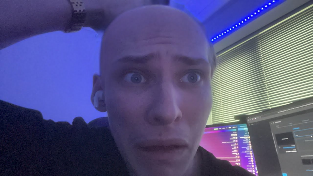10 likes and ill go bald... - YouTube