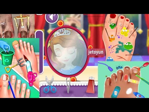 ASMR Hangnail And Agnail Pend the winters// nail care treatment ...