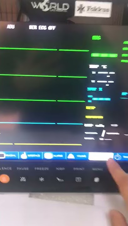MONITOR MULTIPARÂMETRO WL70 - YouTube