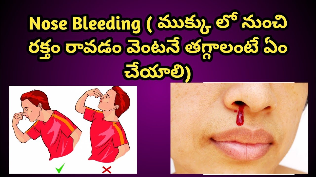 ముక్కు లో నుంచి రక్తం రావడం వెంటనే తగ్గాలంటే ఏం చేయాలి | How to Control ...