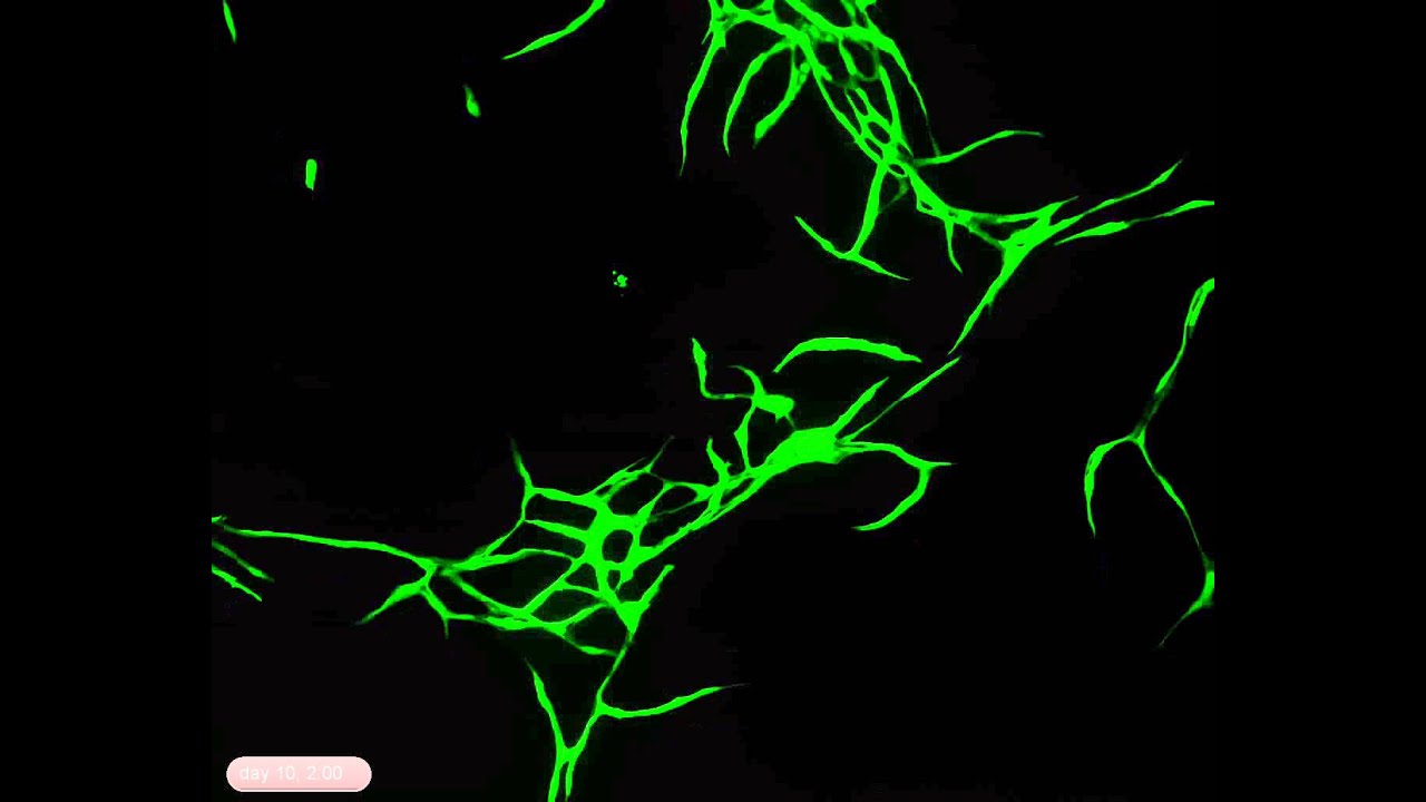 Tubule Formation - GFP transfected HUVEC cells (cellworks.co.uk) - YouTube
