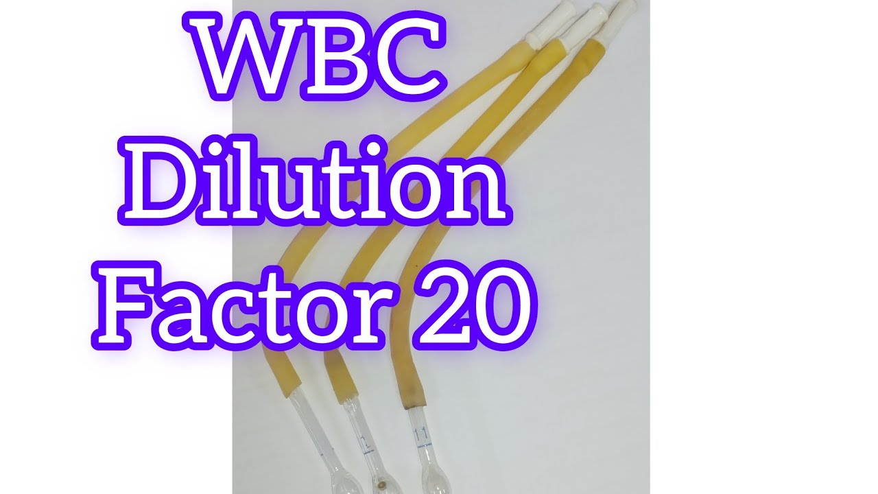 WBC Dilution factor 20 - YouTube