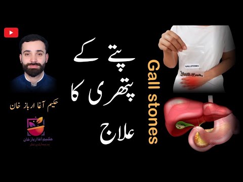 pitay ki patri ka ilaj | Gall stones treatment in Urdu | Hakeem Agha ...