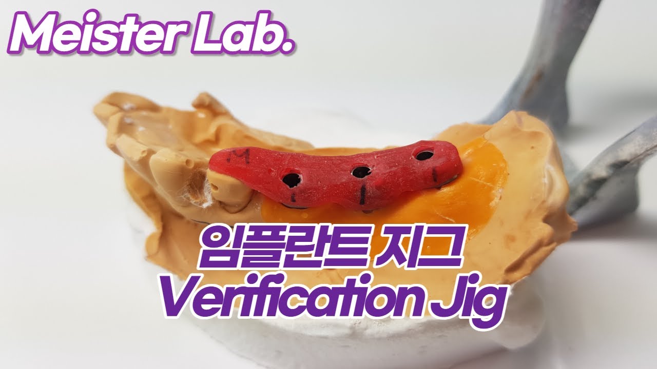 [Lab|실습] 임플란트 지그 | verification jig - YouTube