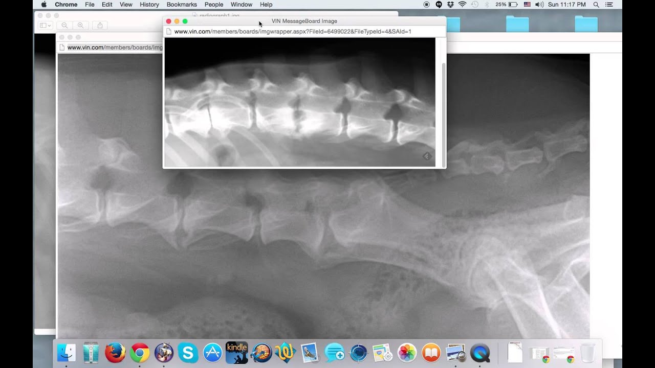 Spondylosis Deformans vs Discospondylitis - YouTube