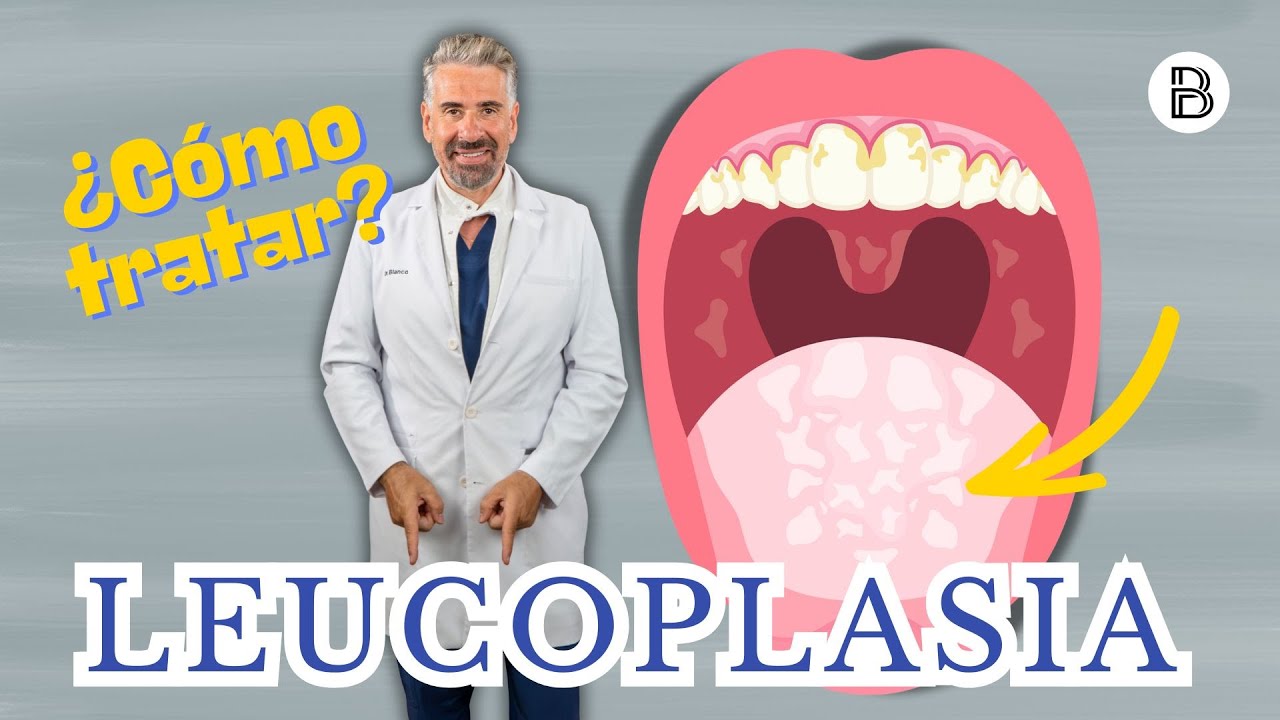 ¿Qué es la leucoplasia y por qué aparece? - YouTube
