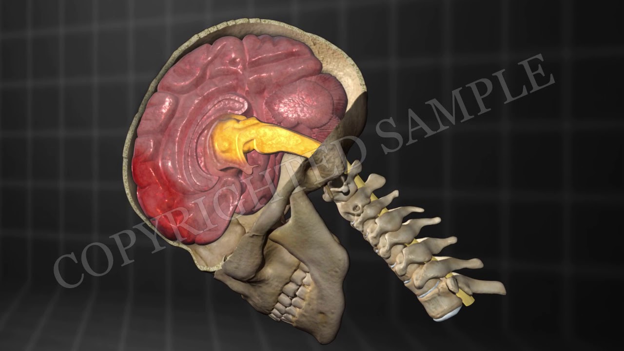 Forensic Animation Brain Injury Stem Stretch - YouTube