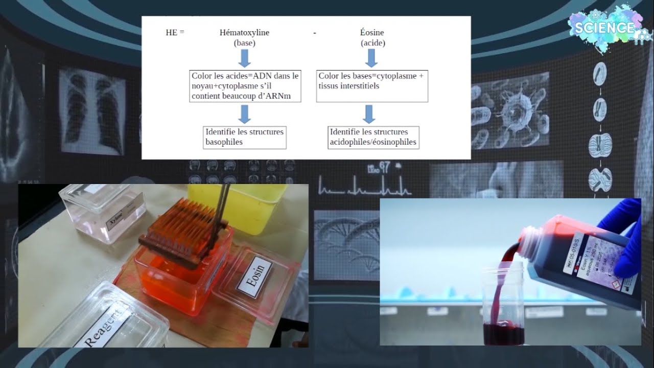 Principe de la coloration à l'hématoxyline et à l'éosine \ anapath ...