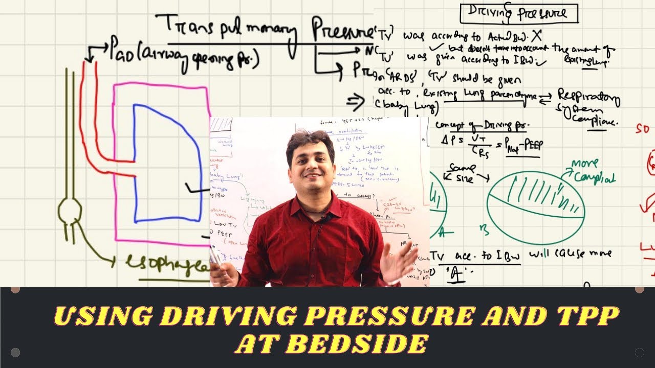 HOW TO USE DRIVING PRESSURE AND TRANSPULMONARY PRESSURE AT BED SIDE ...