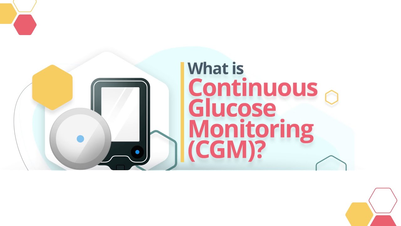 HOW TO: Continuous Glucose Monitoring (CGM) | Medical Channel Asia ...