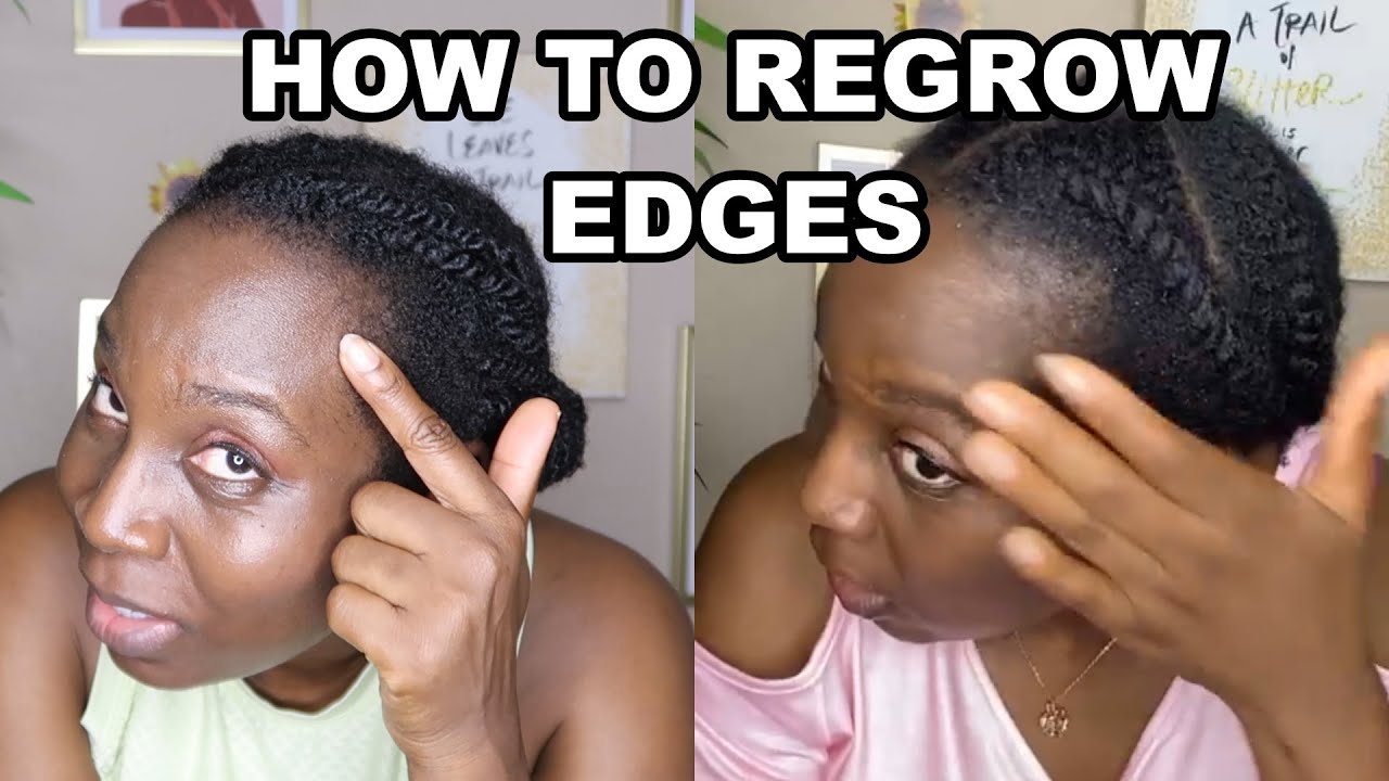 How To Regrow Your Edges - YouTube