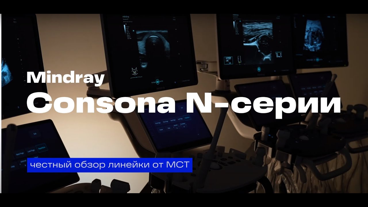 Обзор линейки Mindray Consona N-серии - YouTube