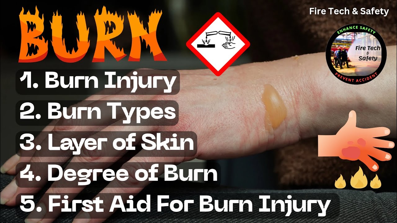 Burn क्या है ? Burn Types & Causes / Skin Layer / Degree of burn / Burn ...
