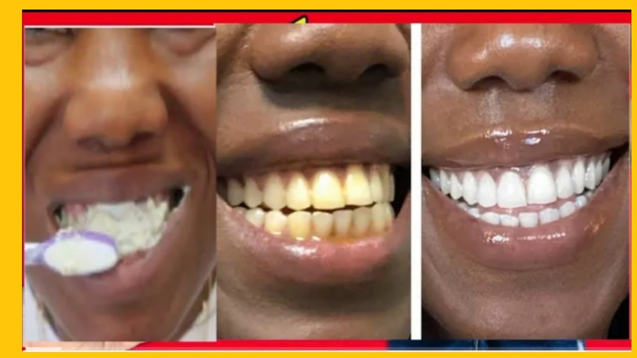 Mauvaise Odeur,Dents Jaunes,Voici un Bain de Bouche Naturel qui agit ...
