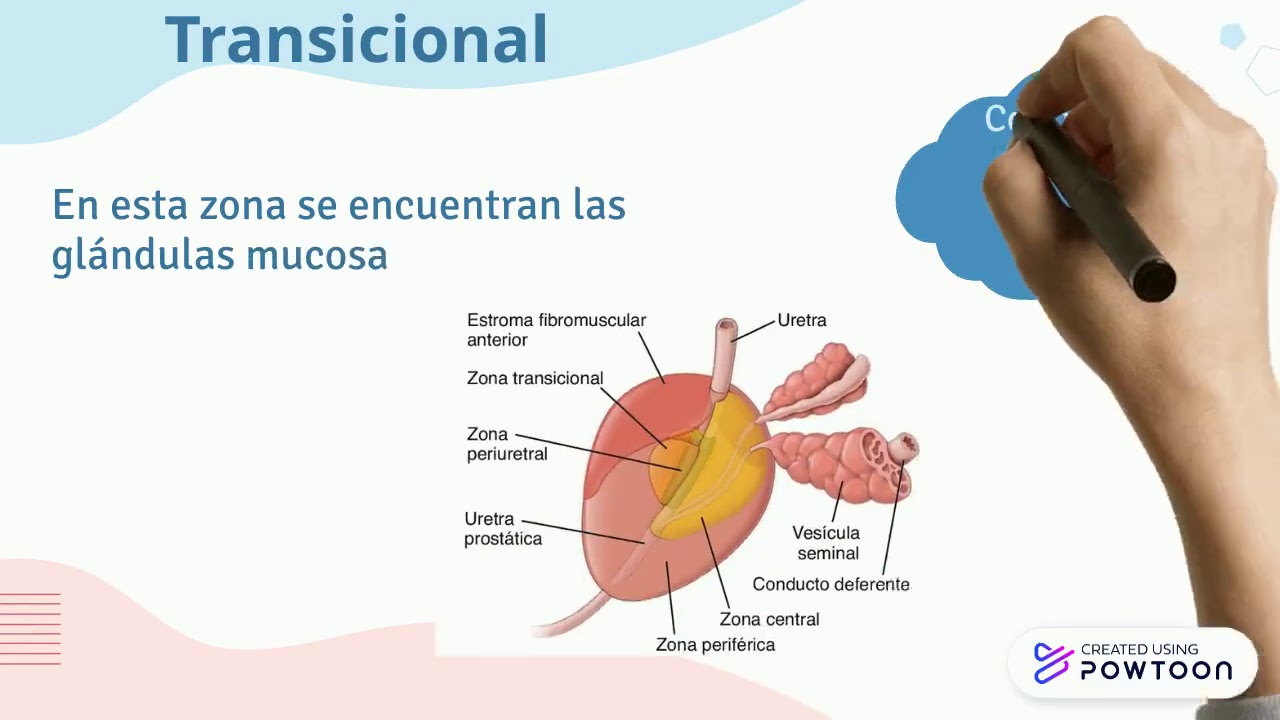 Próstata y Vesículas Seminales, parte 1 - YouTube