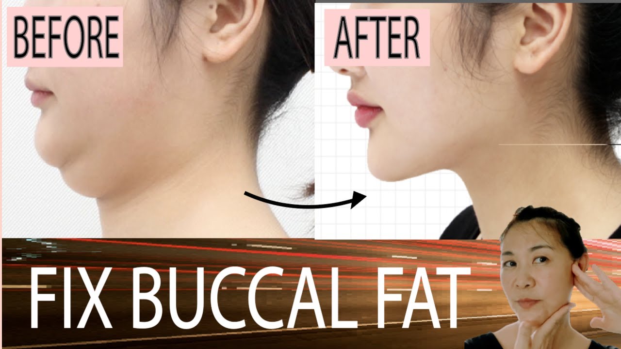 100% EFFECTIVE, FASTEST RESULT! 🔥 A MASSAGE TECHNIQUE FOR SHARPER JAW ...