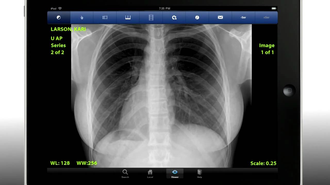 The iClarity iPad App From iCRco - YouTube