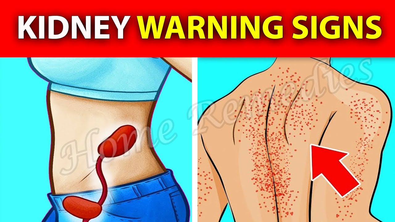 10 Signs Your Kidneys Are Crying For Help (Don’t Ignore These Symptoms ...