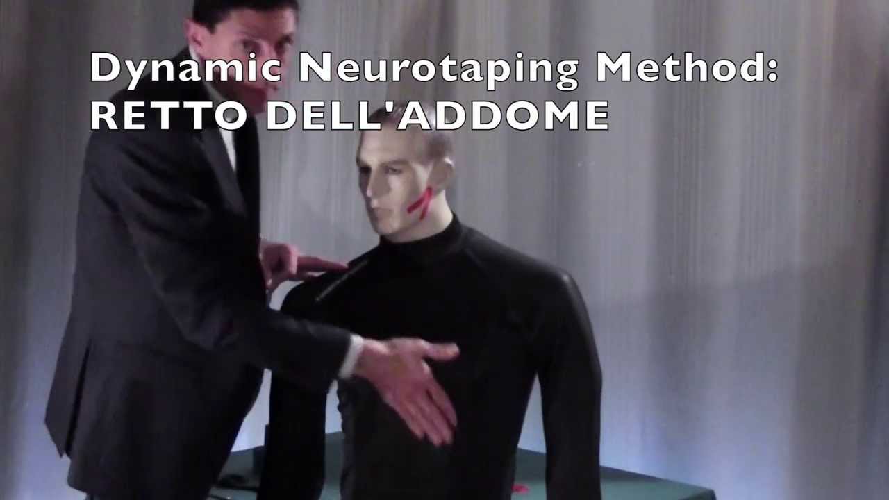 DYNAMIC NEUROTAPING METHOD®: APPLICAZIONE SU MUSCOLO RETTO DELL'ADDOME ...