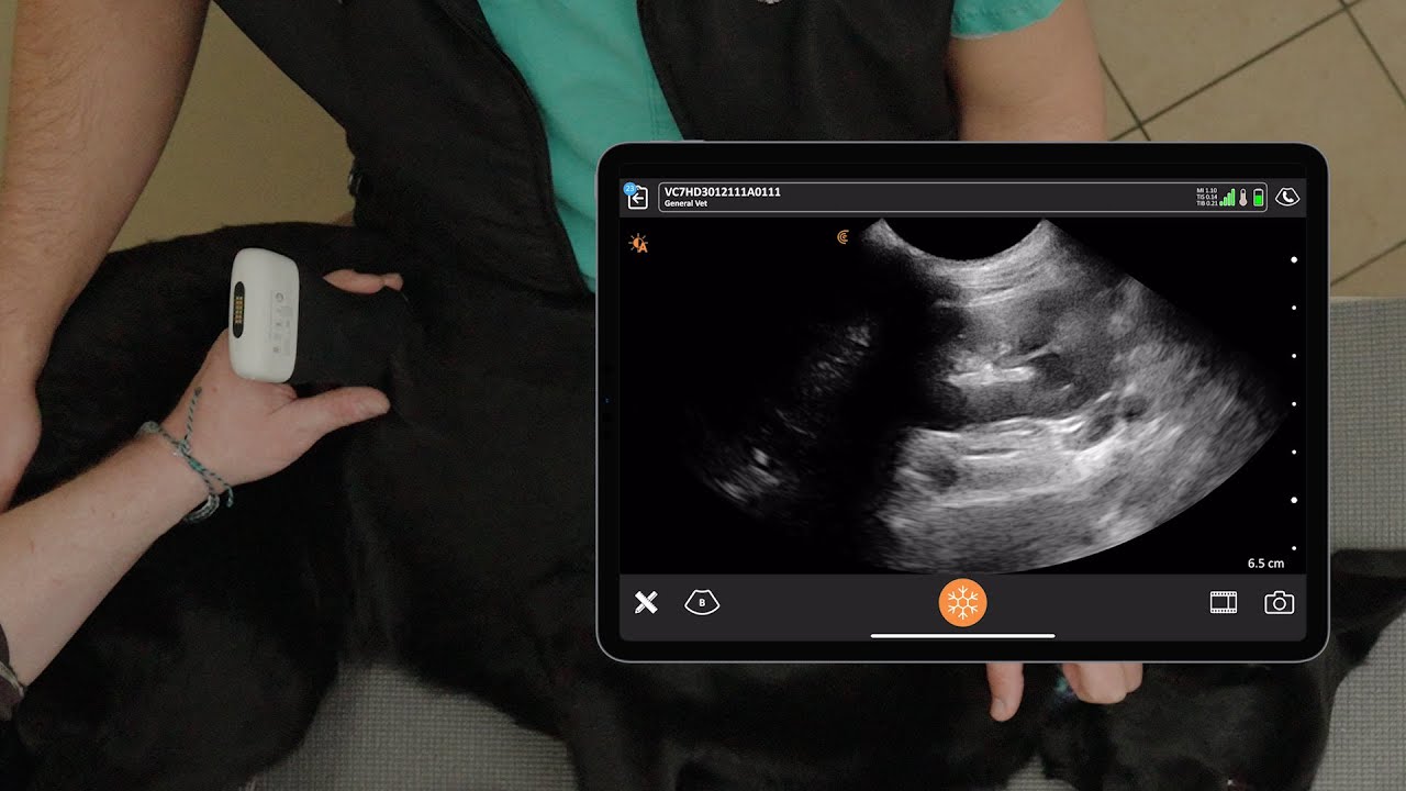 Scanning the Right Paralumbar Site - YouTube