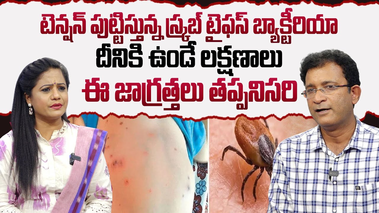Dr Rajesh About Scrub Typhus Disease Symptoms | Precautions for Scrub ...