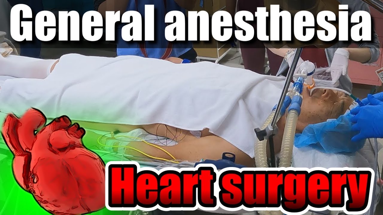 General anesthesia ＆ Heart surgery - YouTube
