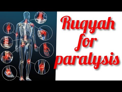 Ruqyah for paralysis