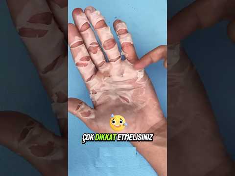 Cildiniz Aniden Soyuluyorsa Dikkat! 😨🔥 #shorts