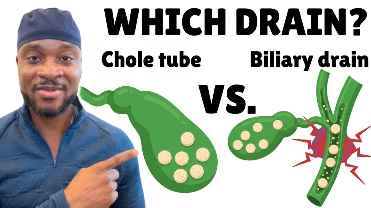Cholecystostomy Tube vs Biliary Drain: How to Choose in Clinical ...