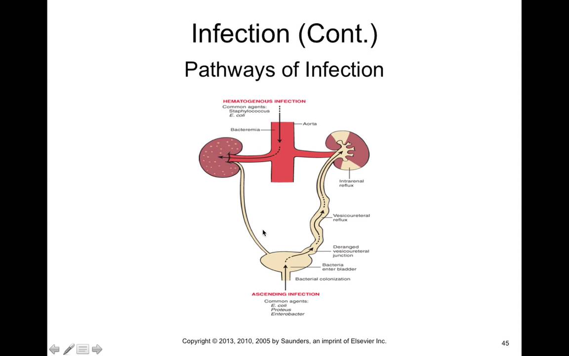 Chapter 27 Intrarenal Disorders BIOL300 - YouTube