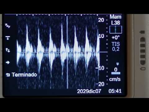 Sonosite 180 Plus _b