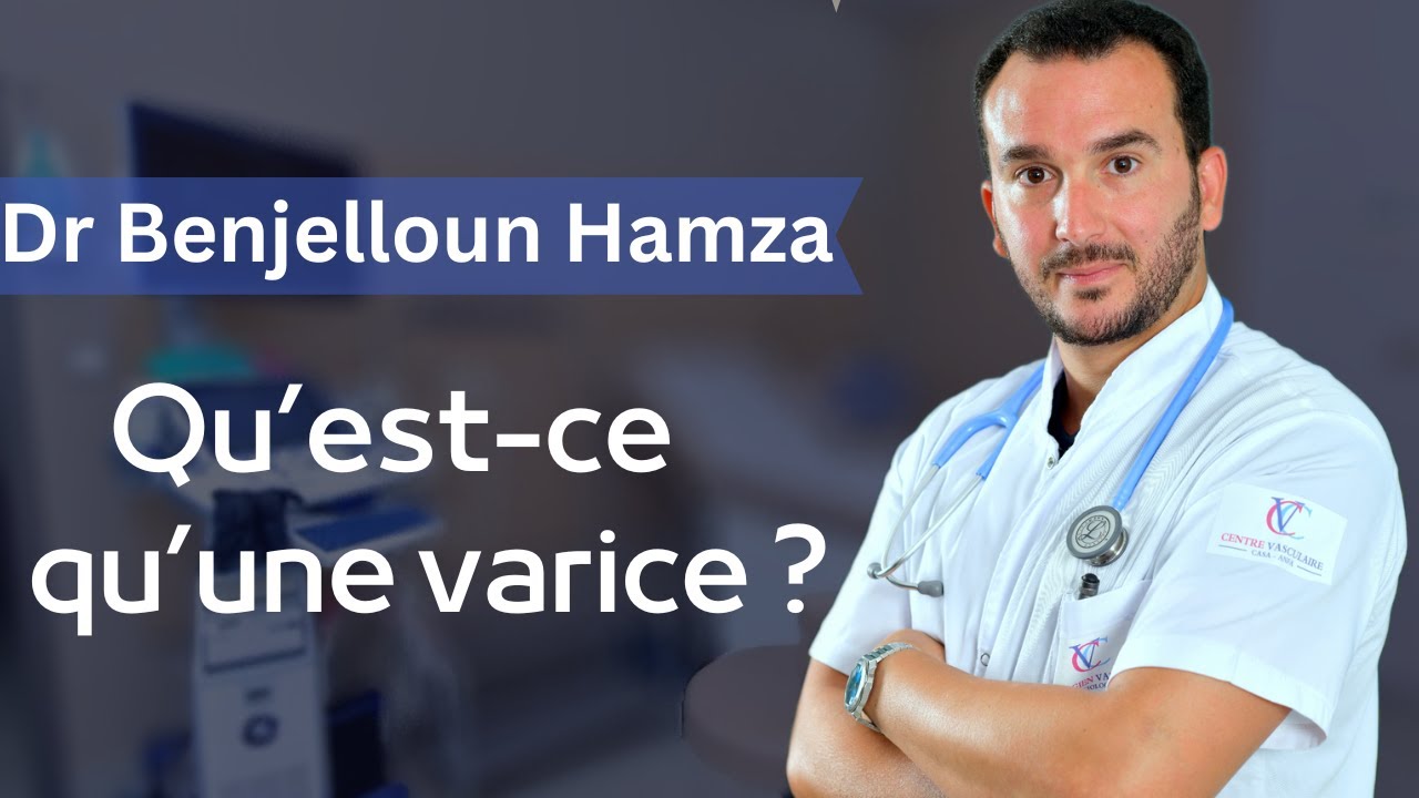 Qu’est-ce qu’une varice ? - YouTube