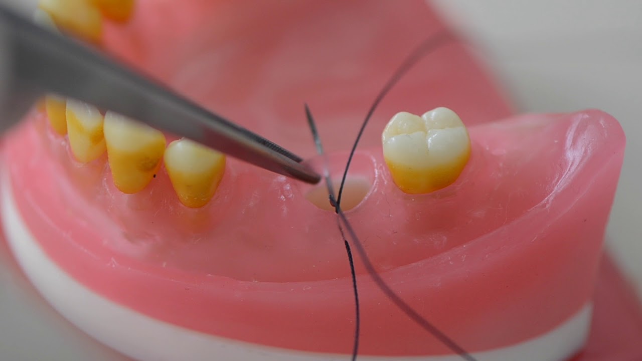 Sutura simples - YouTube