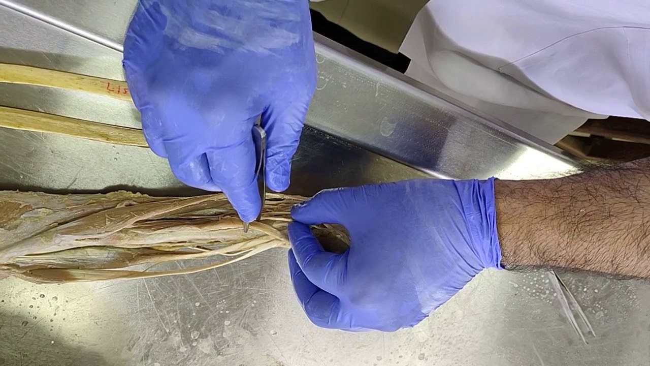 Dissection - Revision of deep muscles of the back of the forearm - YouTube