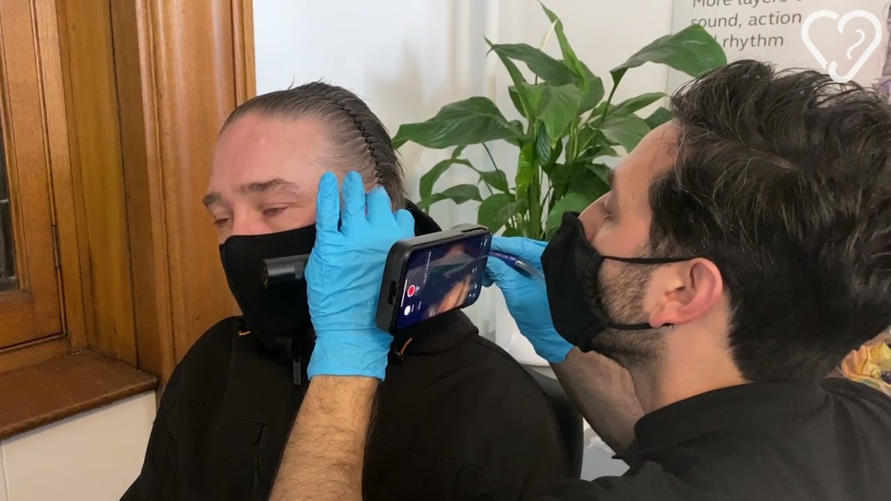 Removal of impacted ear wax plug using the TympaHealth system - YouTube