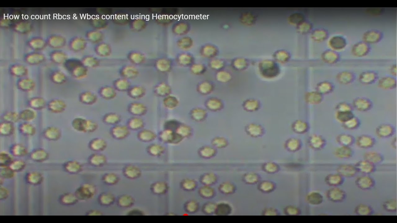 easy way to learn how to count RBCs using Haemocytometer - YouTube