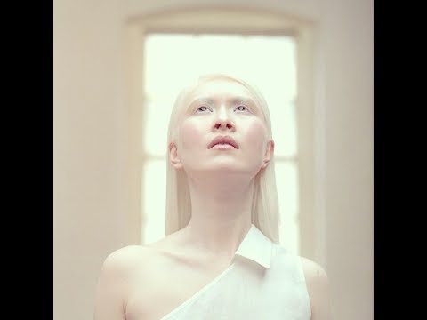8 Charming People With A Unique Skin Color - YouTube