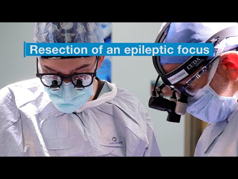 Mayo Clinic Minute - Surgical option for epilepsy – Resection of an epileptic focus