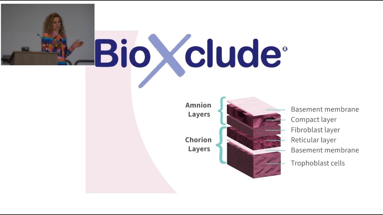 The Membrane That Smiles Back: BioXclude in Clinical Practice - Dr ...