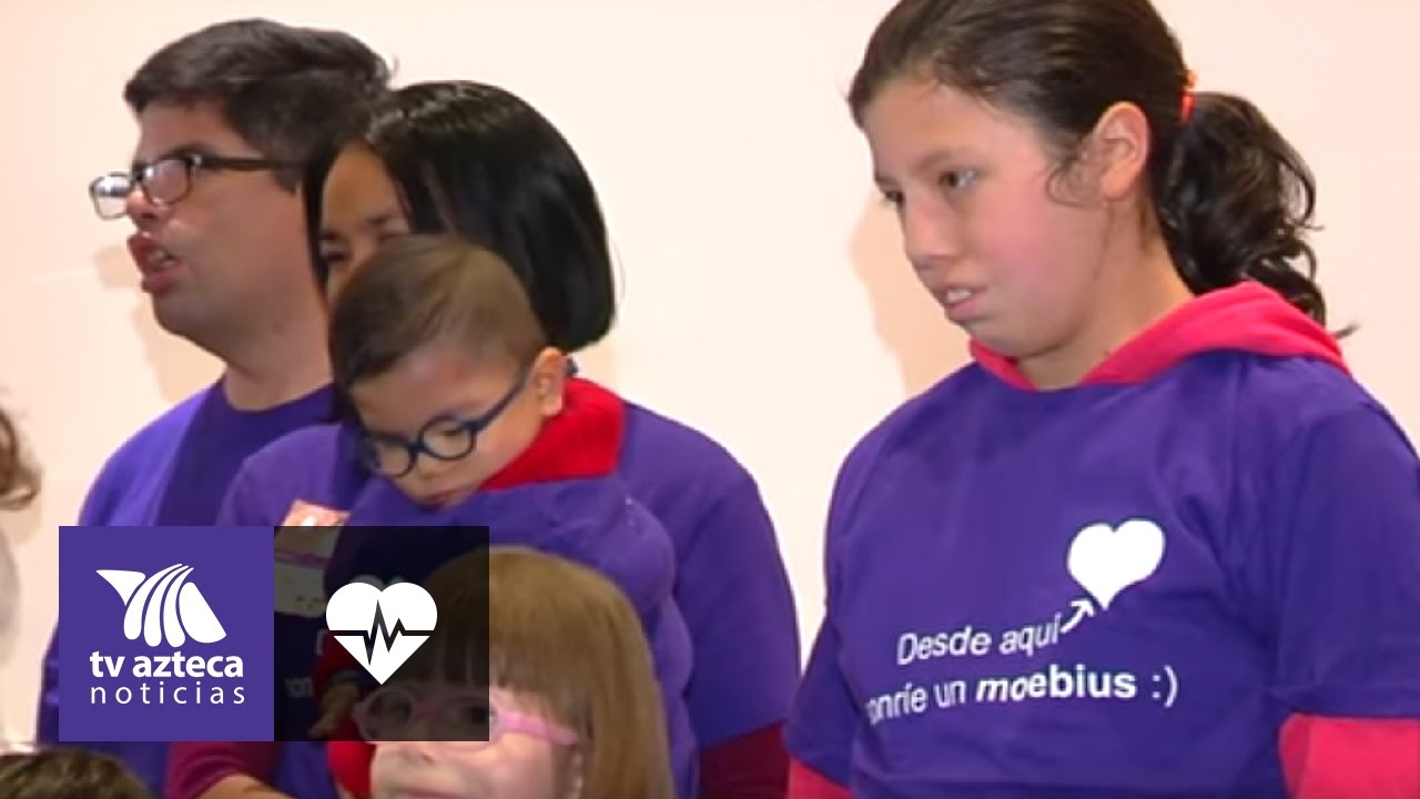 ¿Qué es y cómo afecta a la gente el síndrome de Moebius? - YouTube