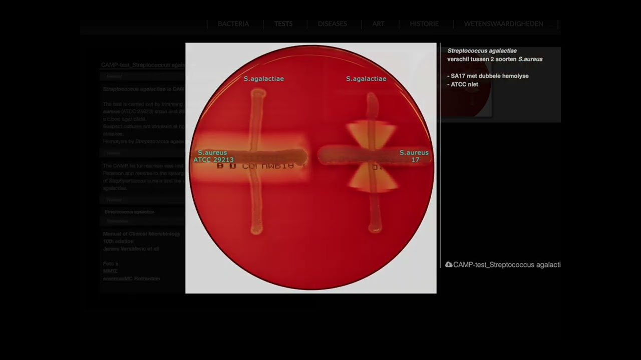 CAMP test Streptococcus agalactiae - Microbiology - YouTube