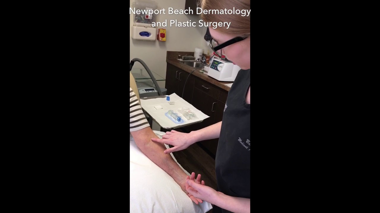 PRP Hair Restoration with Dr. Anne Marie McNeill - YouTube