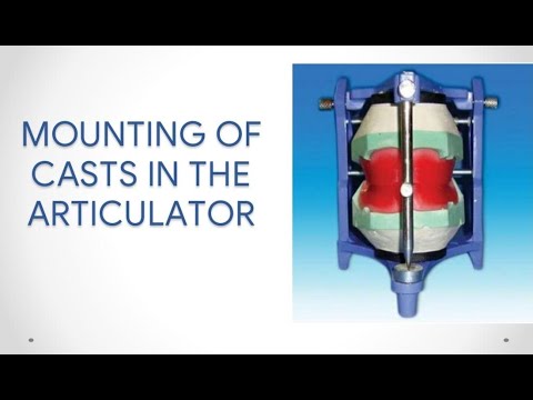 MOUNTING OF CAST IN THE ARTICULATOR || PRECLINICAL PROSTHODONTICS - YouTube