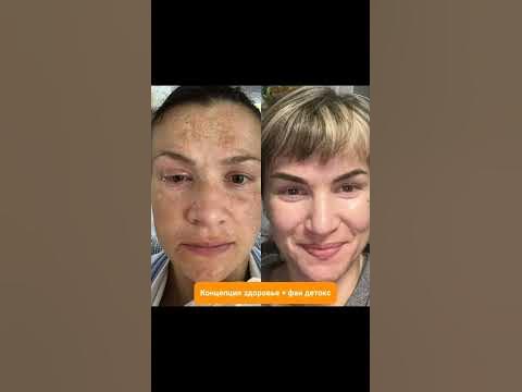 Фан детокс Коралловый клуб - почисти свою печень - YouTube